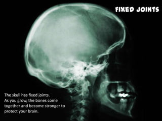 Types of Joints | PPTX