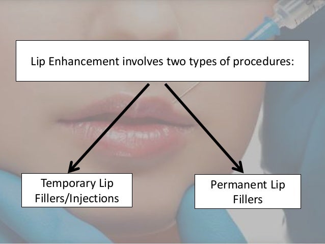 Types of Lip Augmentation Procedures
