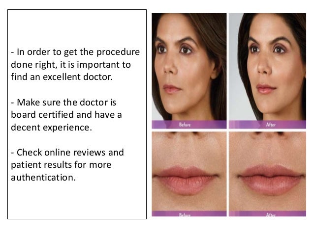 Types of Lip Augmentation Procedures