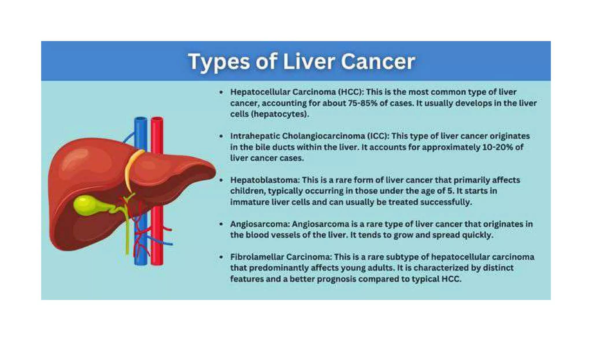 Types of Liver Cancer | PDF