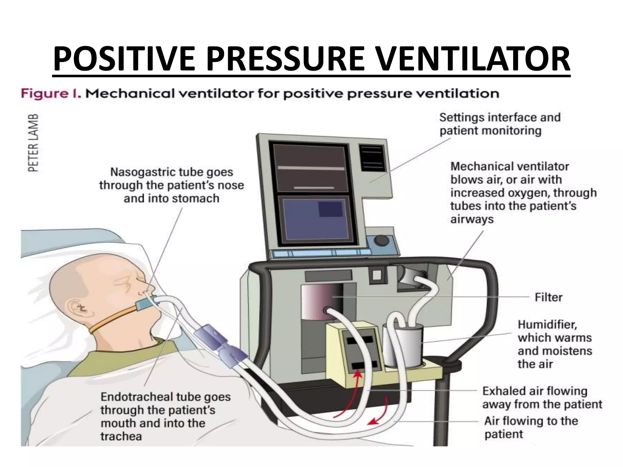 TYPES OF MECHANICAL VENTILATORS | PPTX