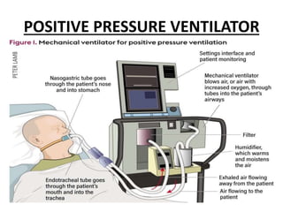 TYPES OF MECHANICAL VENTILATORS | PPTX | Lung and Respiratory Health ...