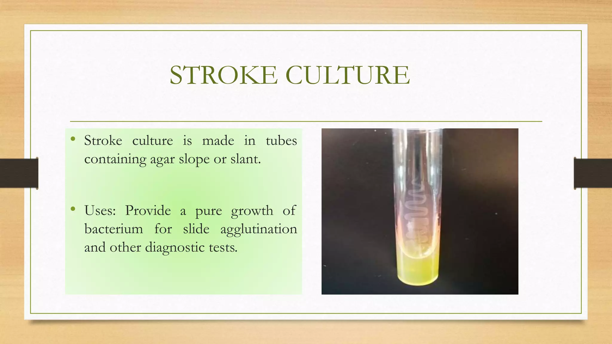 Types of Media in Microbiology & Plating Techniques. (1).pptx