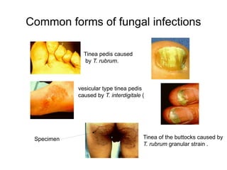 Types of microbes in Microbiology ppptx none | PPTX