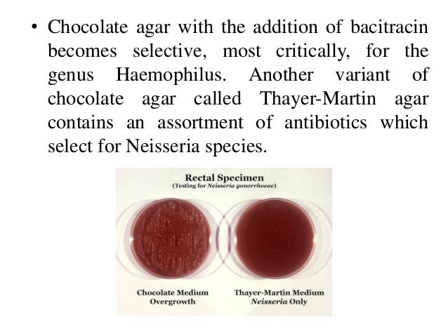 Types of microorganisms media