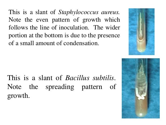 Types of microorganisms media