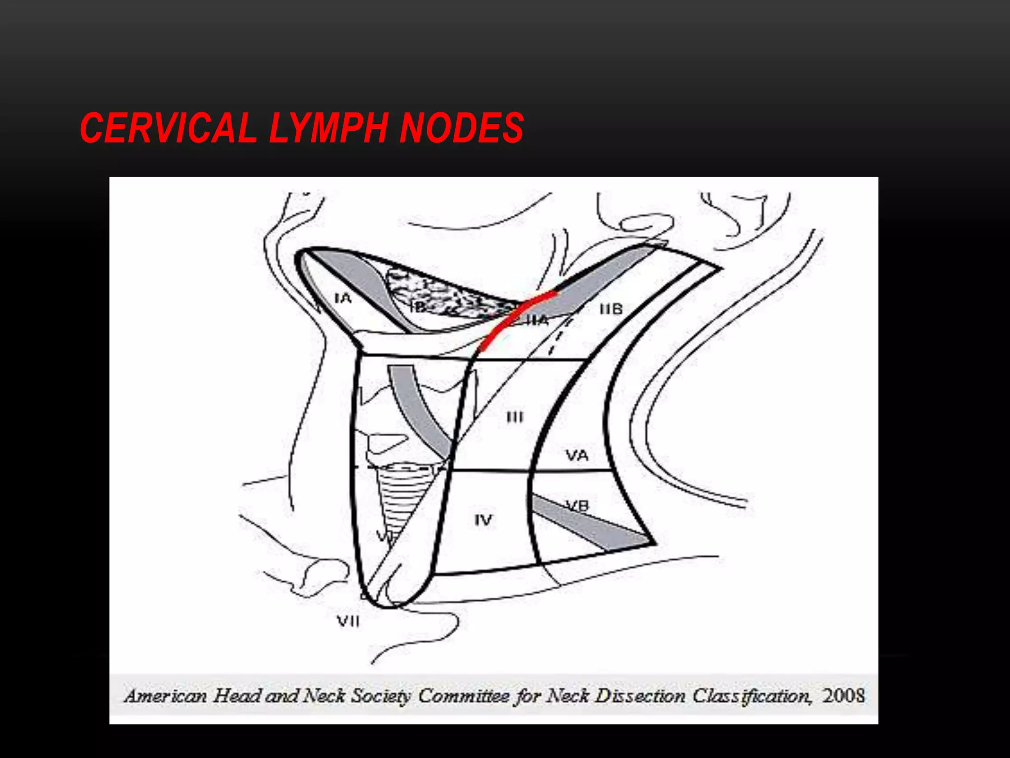 Types of neck dissection | PPTX