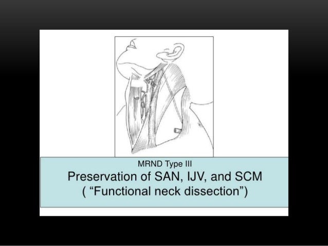 Types of neck dissection