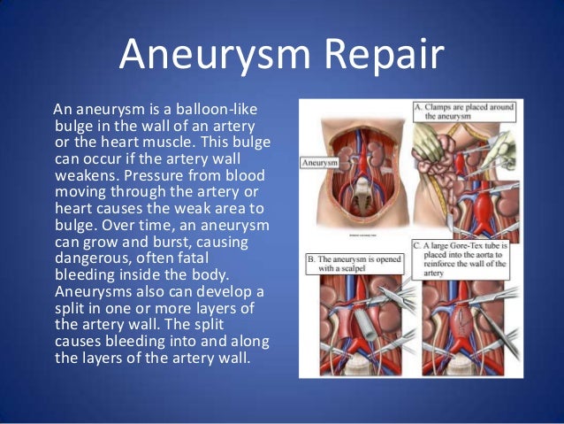 Types of cardiothoracic surgery - bapshort