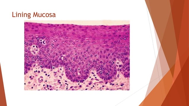 Types of oral mucosa | PPT