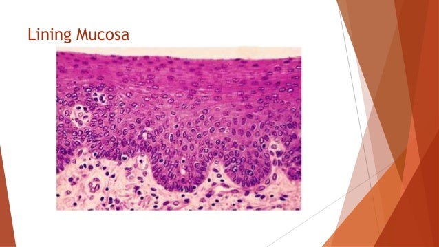 Types of oral mucosa
