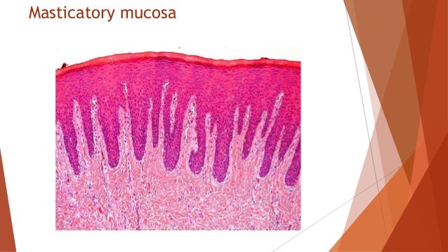 Types of oral mucosa
