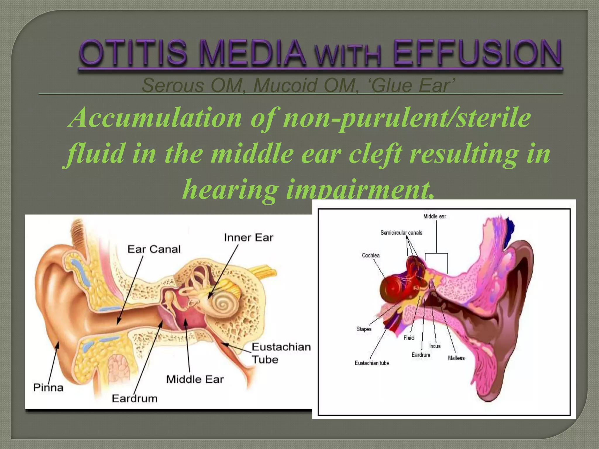 Types of Otitis Media by Dr. Haseeb Ahmed - dec 2011 | PPTX