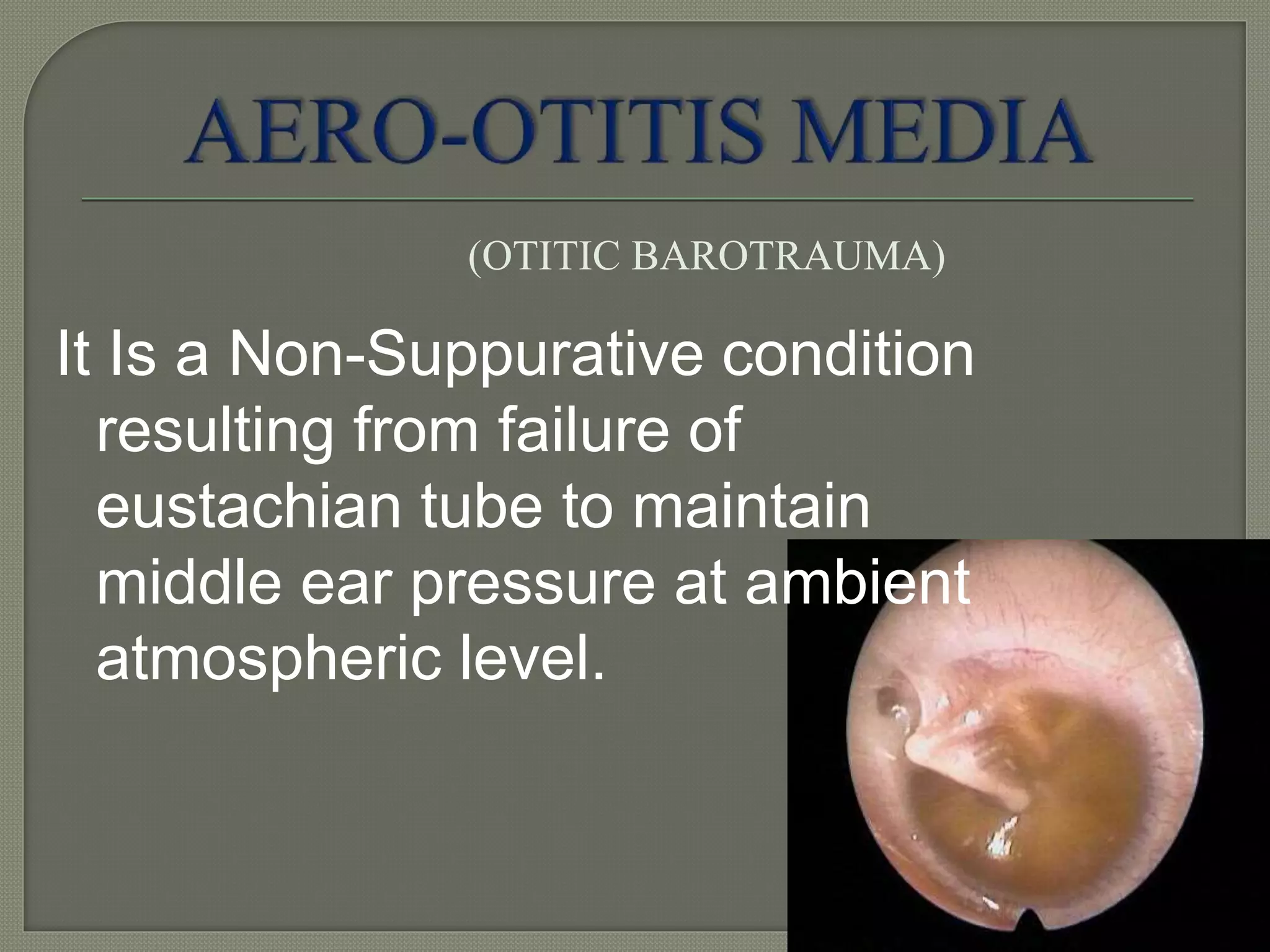 Types of Otitis Media by Dr. Haseeb Ahmed - dec 2011 | PPT