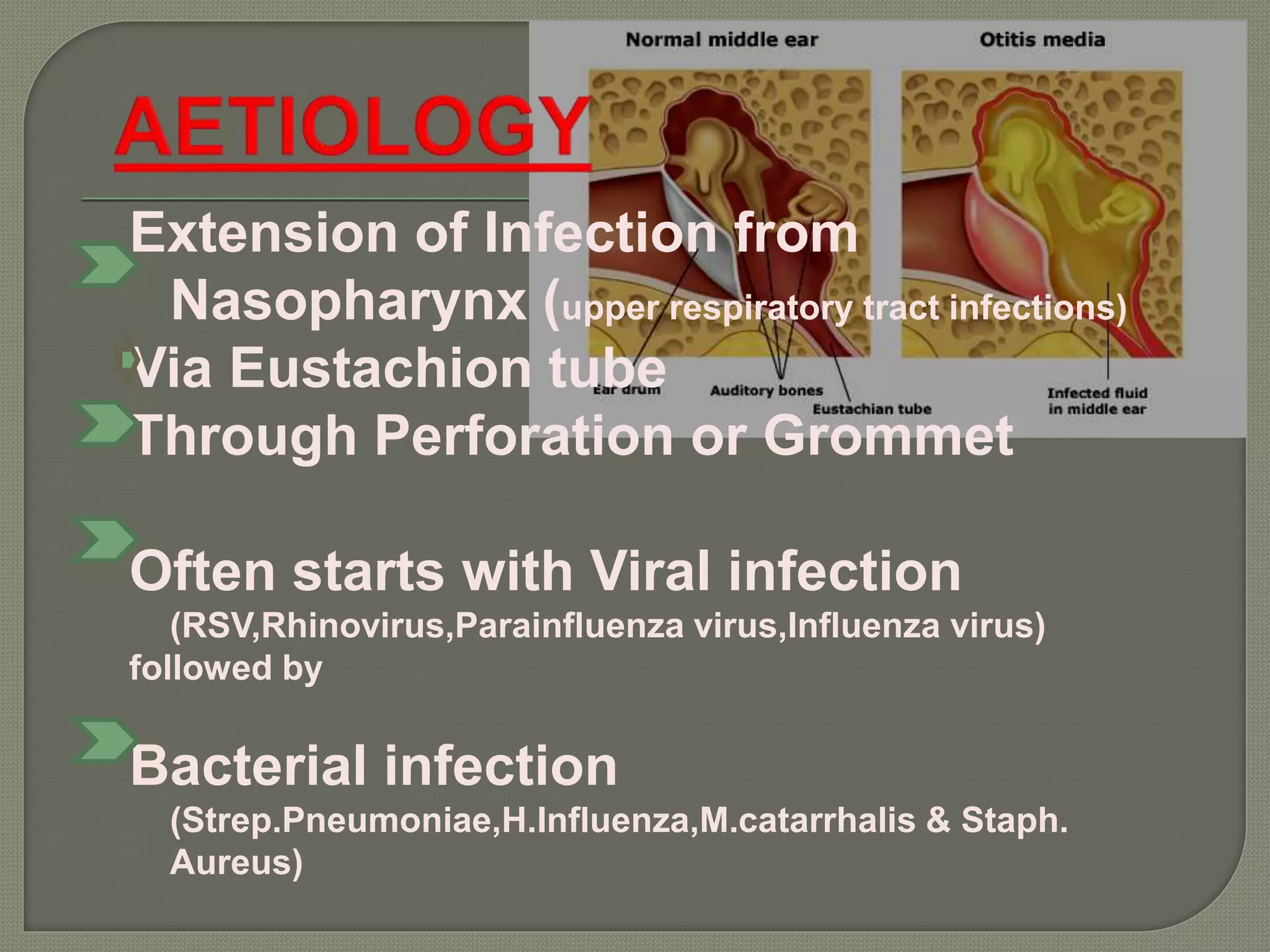Types of Otitis Media by Dr. Haseeb Ahmed - dec 2011 | PPTX