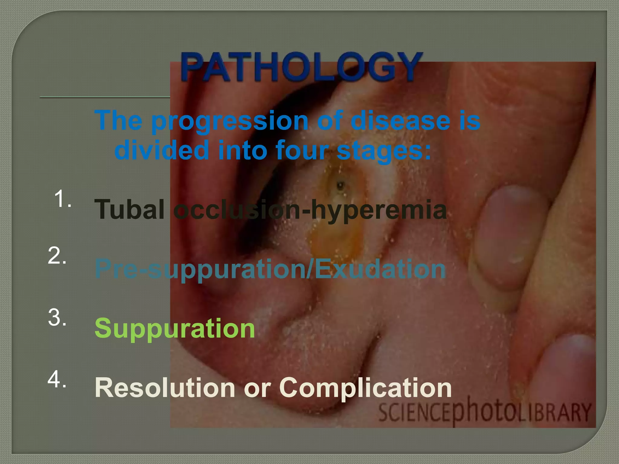 Types of Otitis Media by Dr. Haseeb Ahmed - dec 2011 | PPTX