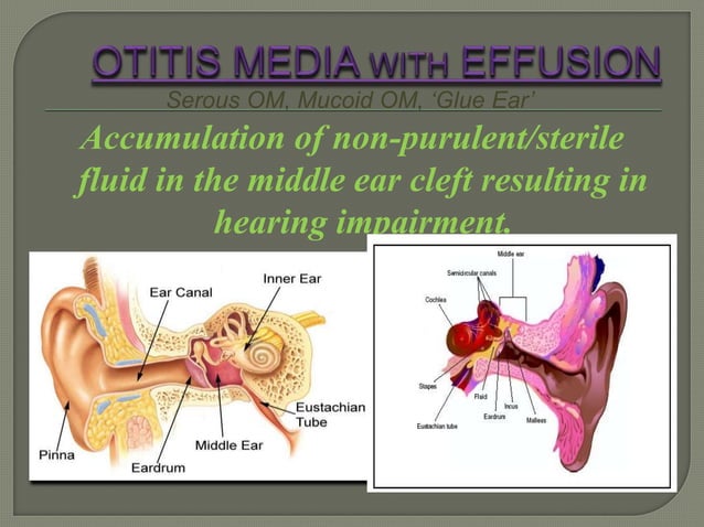 Types of Otitis Media by Dr. Haseeb Ahmed - dec 2011 | PPT