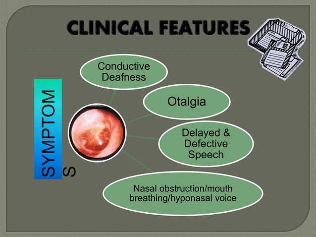 Types of Otitis Media by Dr. Haseeb Ahmed - dec 2011 | PPTX