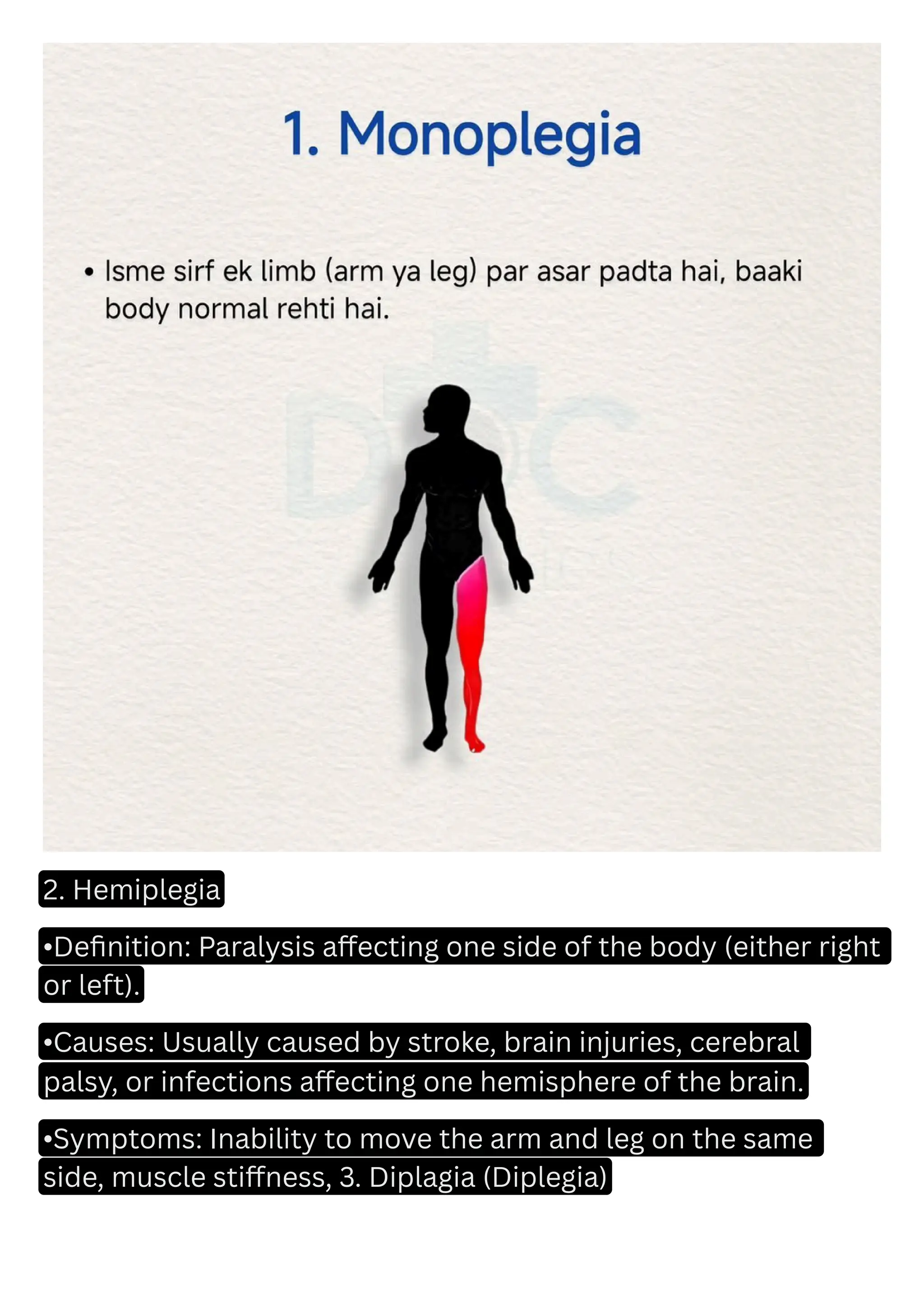 Types of paralysis How many types of paralysis. | PDF