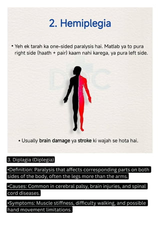 Types of paralysis How many types of paralysis. | PDF