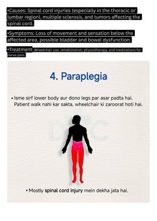 Types of paralysis How many types of paralysis. | PDF