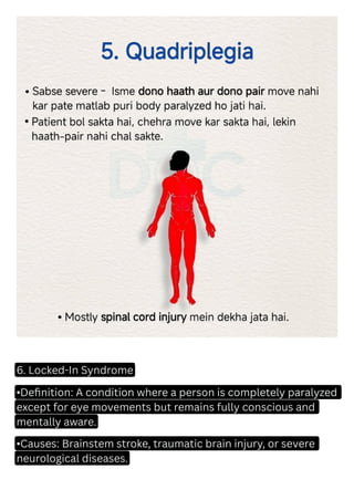Types of paralysis How many types of paralysis. | PDF