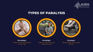 Insights on Different Types of Paralysis | PPTX