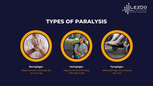 Insights on Different Types of Paralysis | PPTX