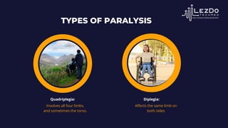 Insights on Different Types of Paralysis | PPTX