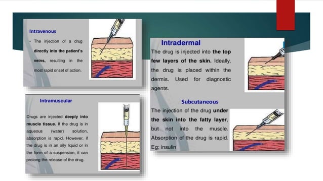 Types of parenteral formulations