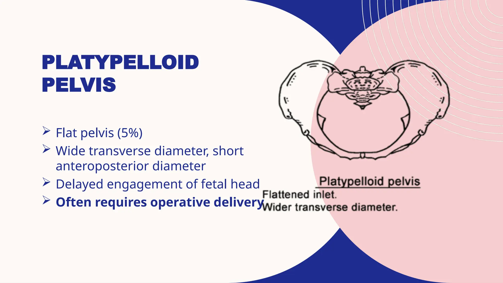 Types of pelvis.pptx 12345678kdkdkdkdkdkkdkd | PPTX