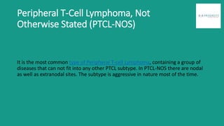 Types Of Peripheral T-Cell Lymphoma | PPTX