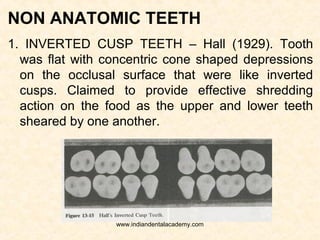 Types of posterior teeth /fixed orthodontics courses | PPT