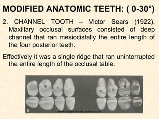 Types of posterior teeth for cd/ oral surgery courses | PPT