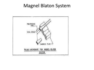 types of prestressing with diagrams.pptx
