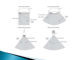 Types of Ultrasound Probes | PPTX