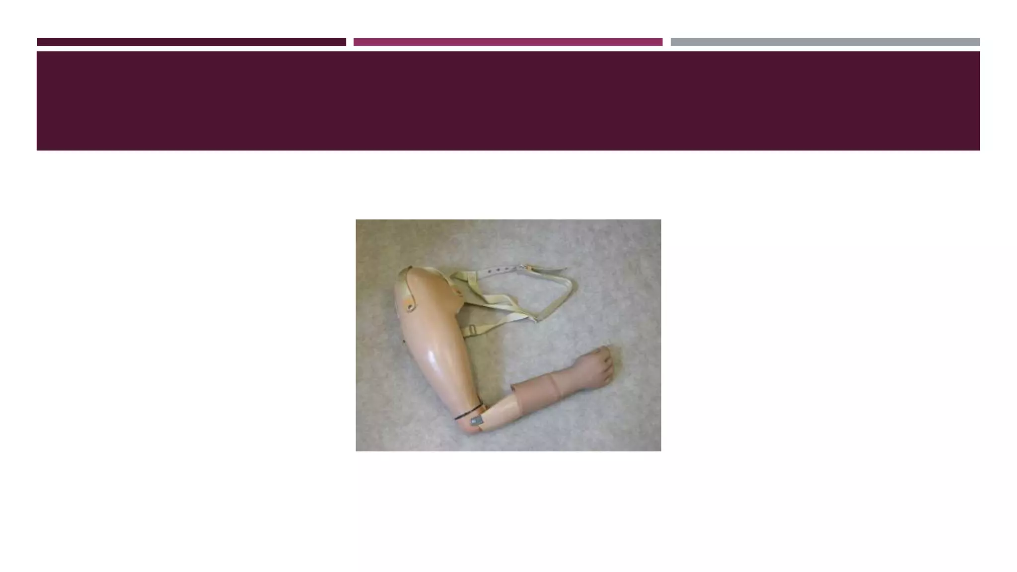 types of prostheses and advantages with disadvantages.pptx