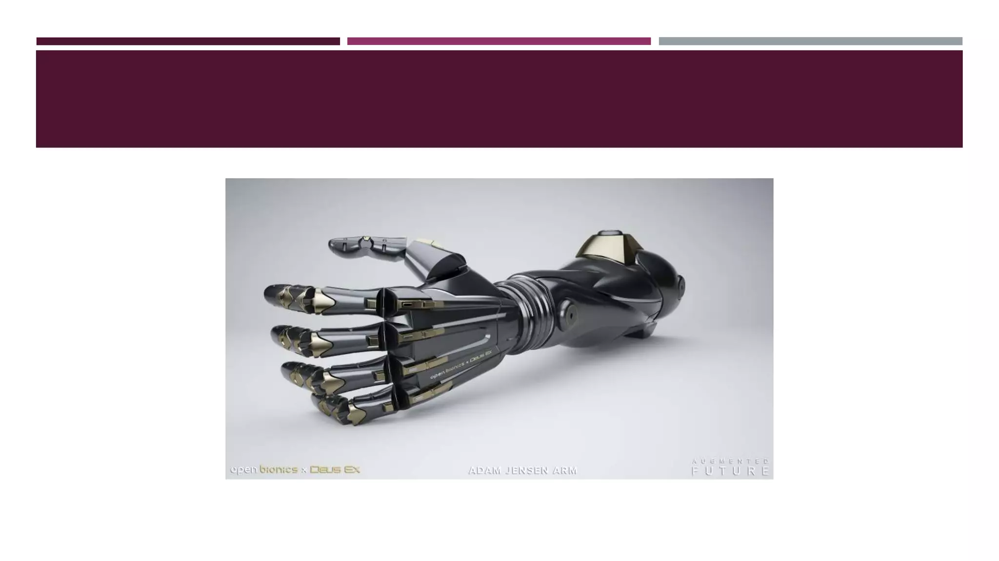 types of prostheses and advantages with disadvantages.pptx