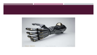 types of prostheses and advantages with disadvantages.pptx