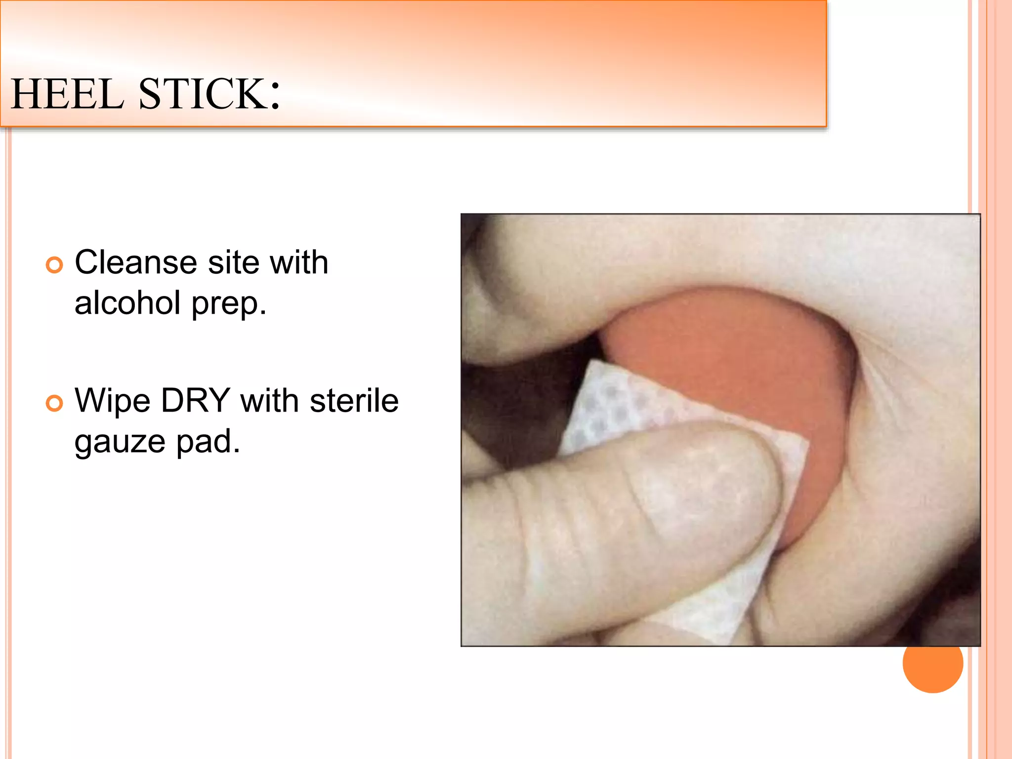 Types of punctures | PPTX