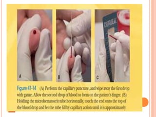 Types of punctures | PPTX