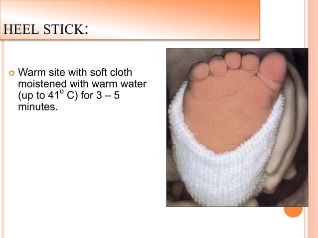 Types of punctures | PPTX