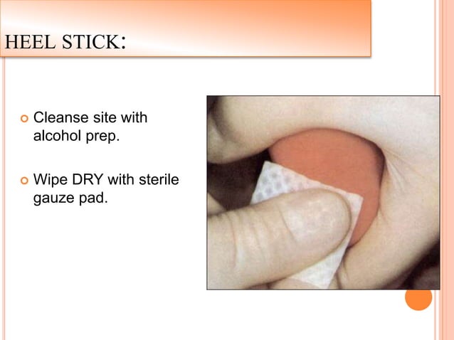 Types of punctures | PPT