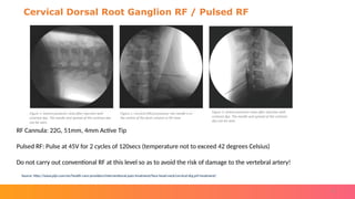Types of Radiofrequency Ablation Procedures (Avanos).pptx