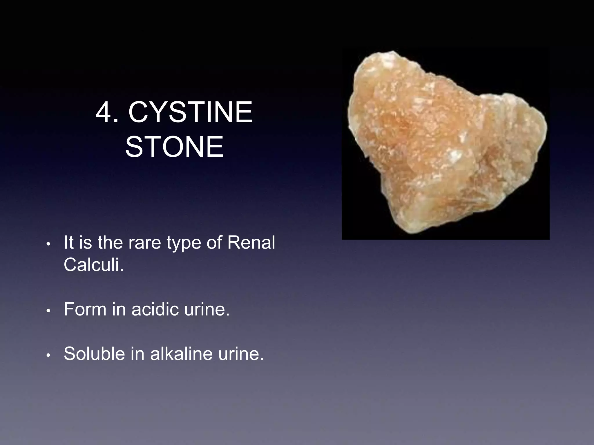 TYPES OF RENAL CALCULI | PPTX