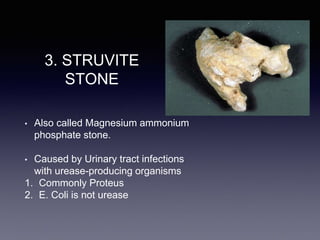 TYPES OF RENAL CALCULI | PPTX