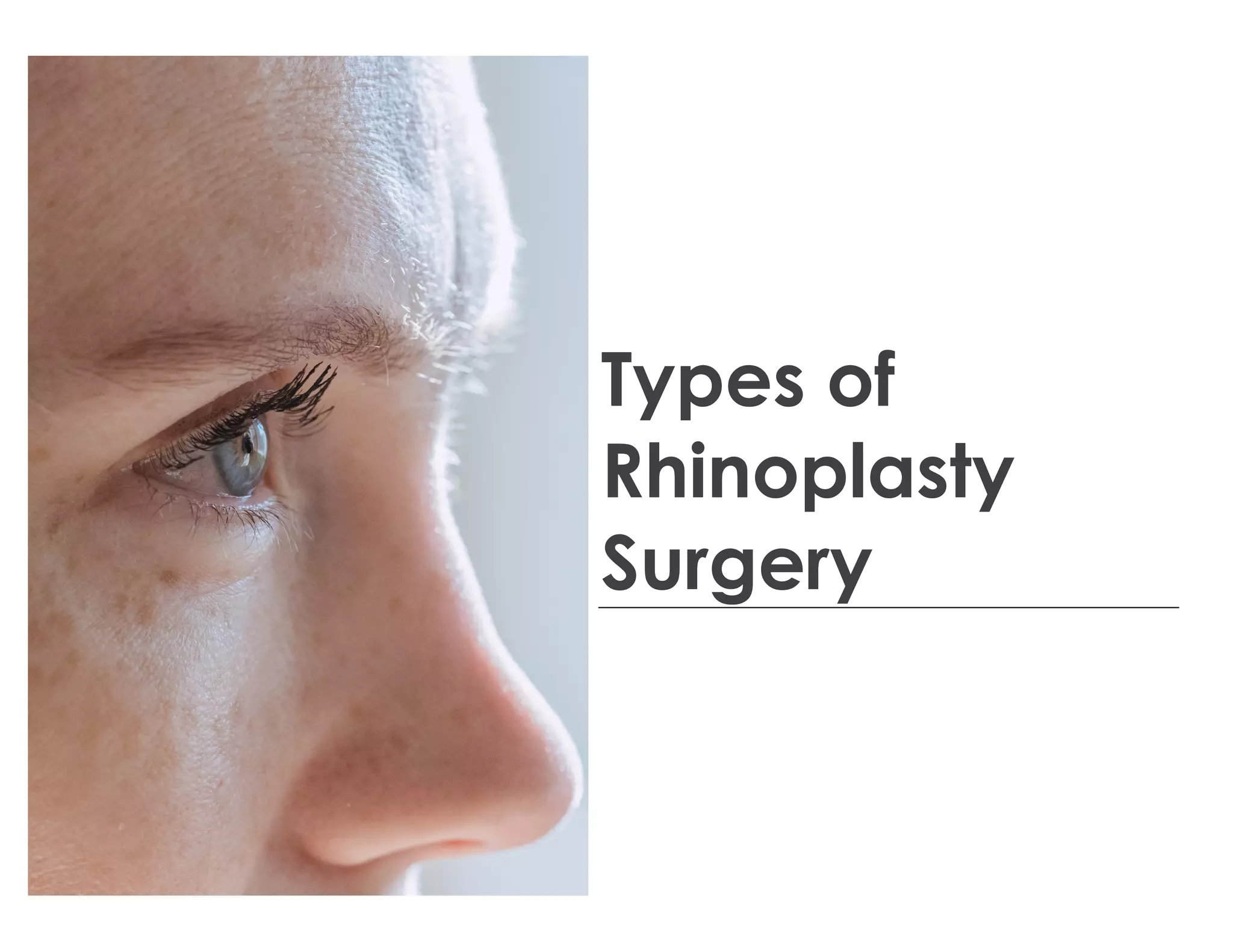 Types of Rhinoplasty Surgery | PDF