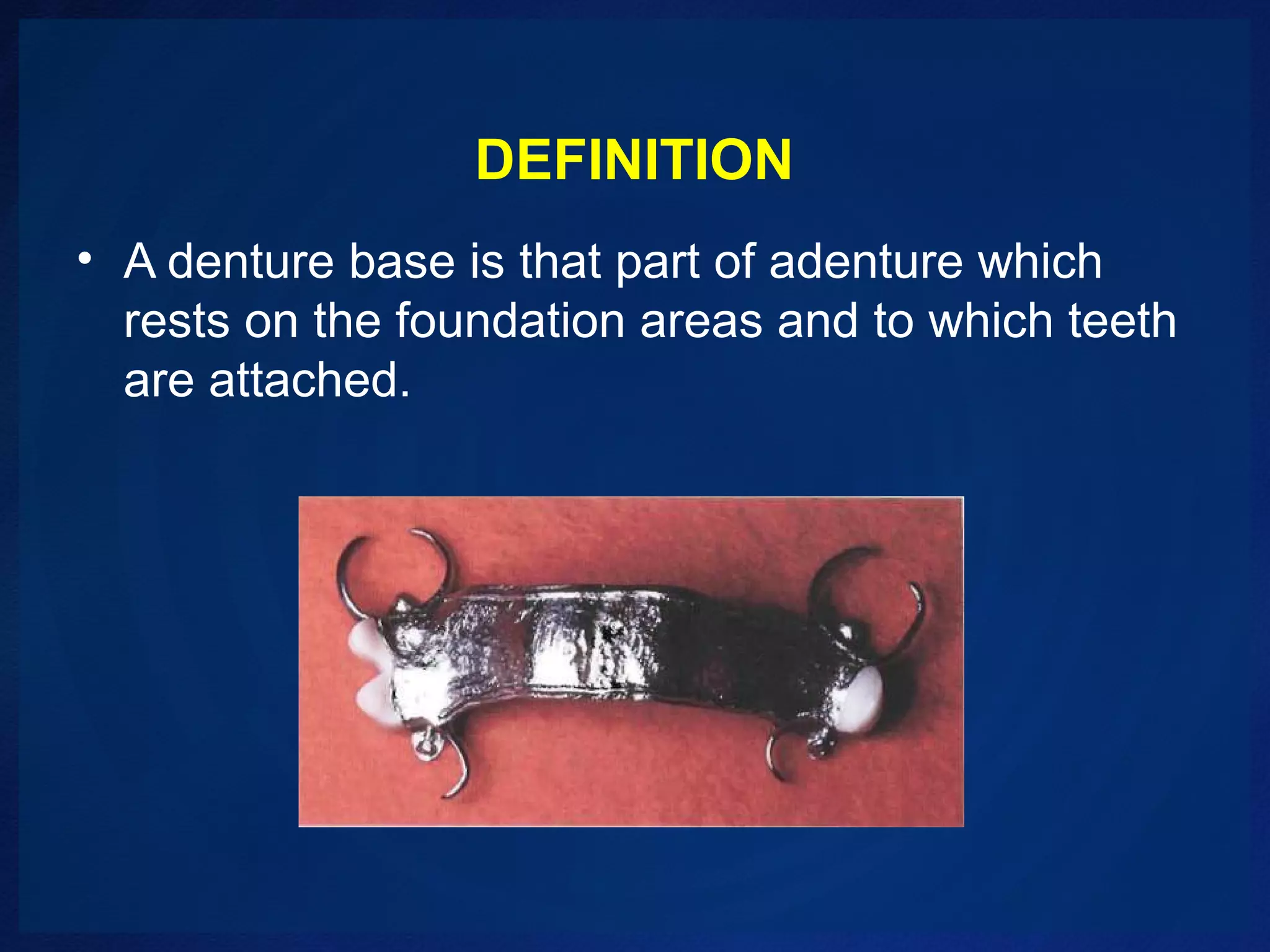 Types of RPD base (Metalic) | POT