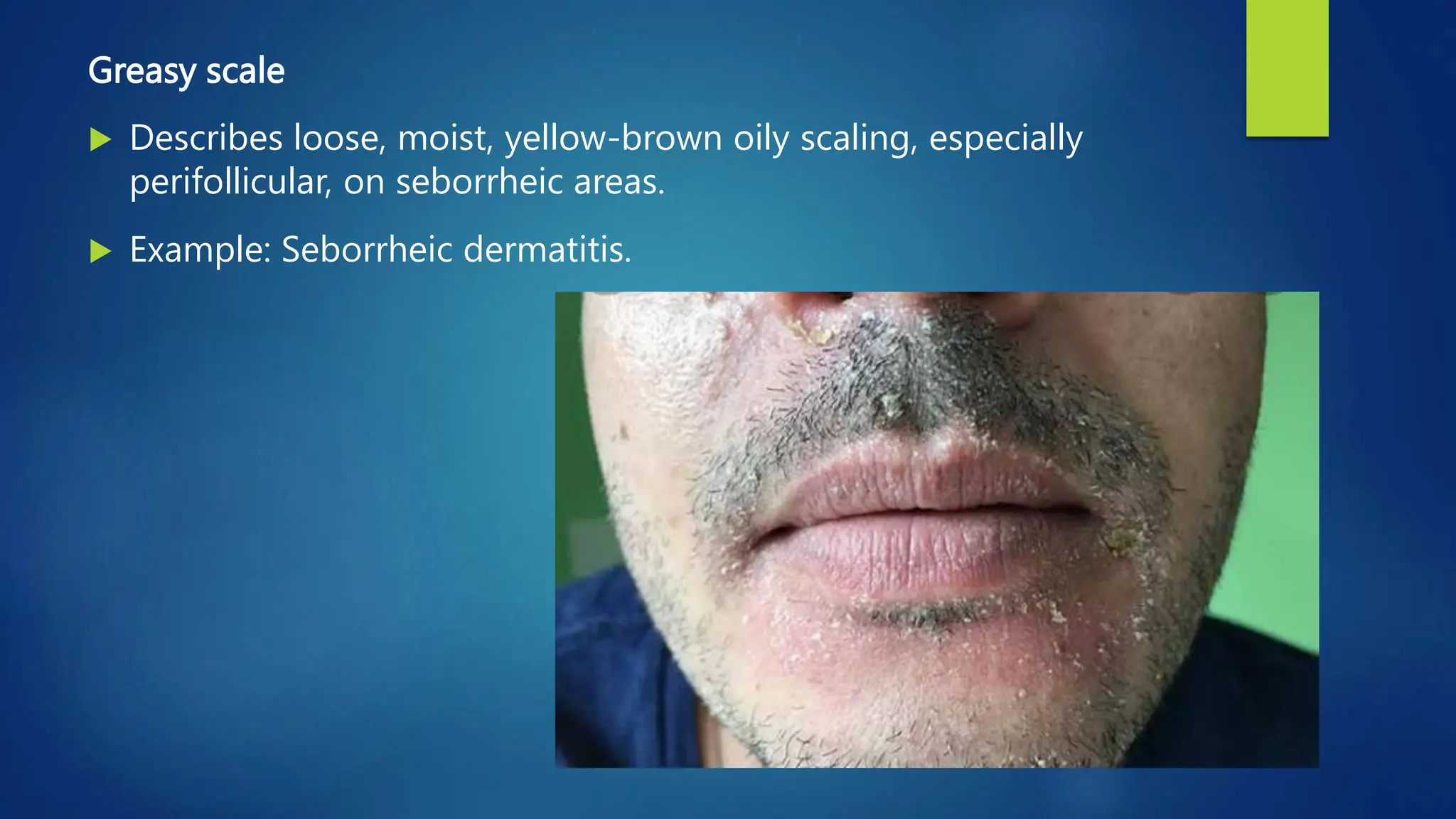 Scaly signs in dermatology. Article discussion | PPTX