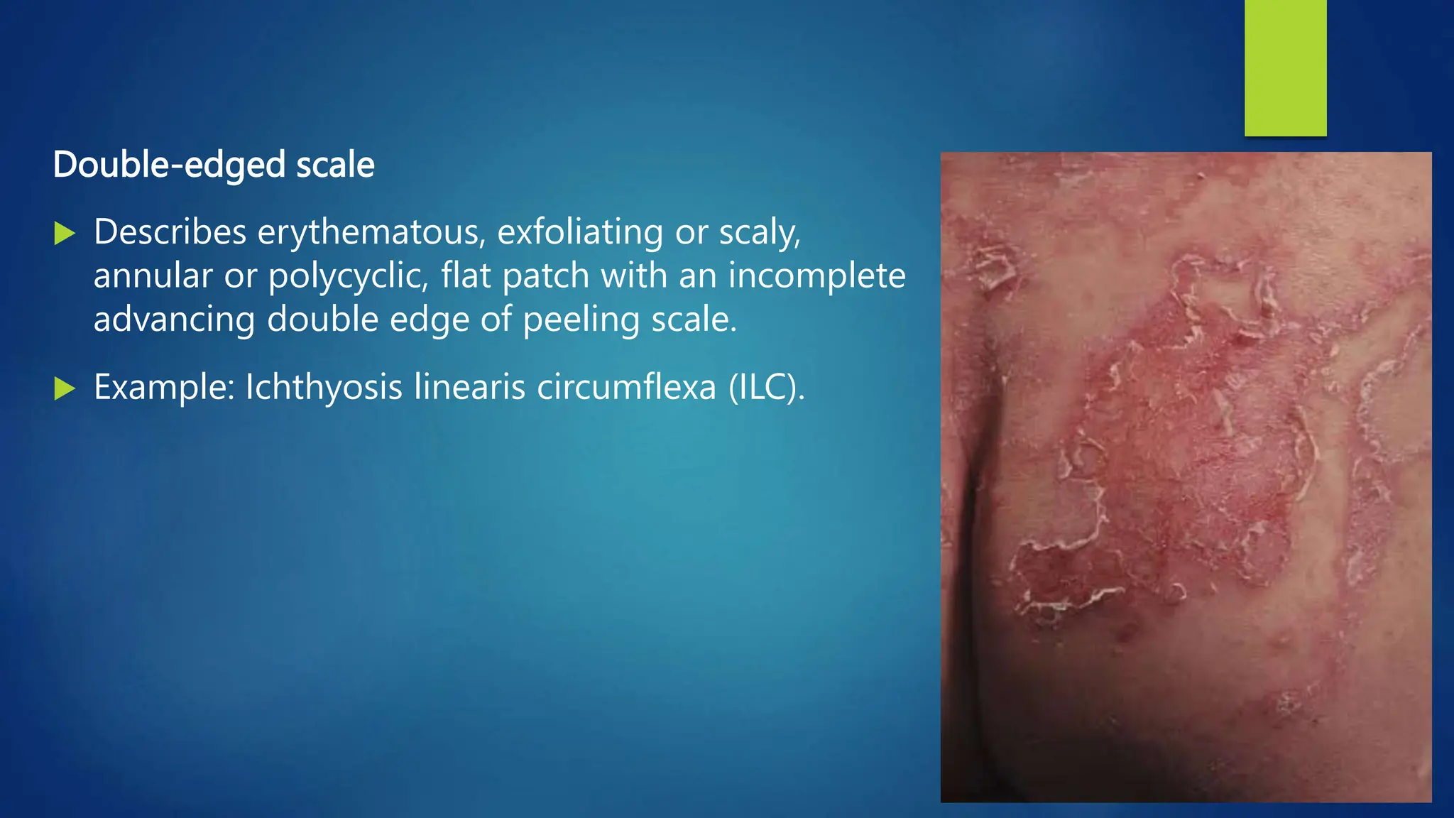 Scaly signs in dermatology. Article discussion | PPTX